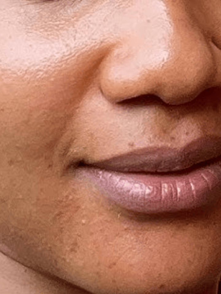 Resurface Anti-tan peeling gel